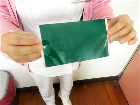 使用痠痛貼布 過量恐會傷腎 自由健康網