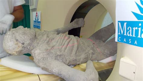 Encased In Plaster Scientific Revelations From The Casts Of Pompeiis Victims Getty