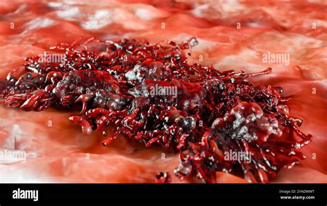 Cancer Cell Growth Uncontrollably Over Tissue Tumor Infection Cells