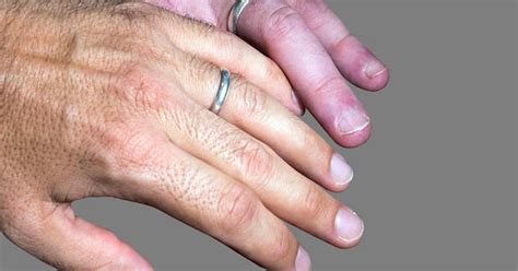 Nebraska Same Sex Marriage Ban Blocked By Federal Judge Cbs News