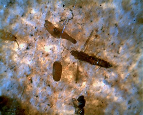 Dust Particles Under Microscope