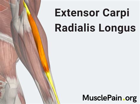 Forearm Trigger Points Muscle Pain