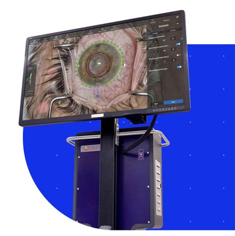 Ngenuity 3d Cataract Surgery In Austin Tx Westlake Eye Specialists