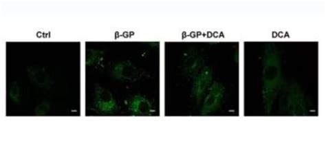 2 Nbdg Fluorescence Labeled 2 Deoxy Glucose Analog Glpbio