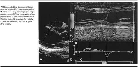 Tissue Doppler Echocardiography Current Opinion In Cardiology