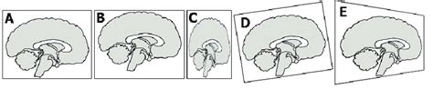 An Illustration Of The Common Affine Transformations A Represents The