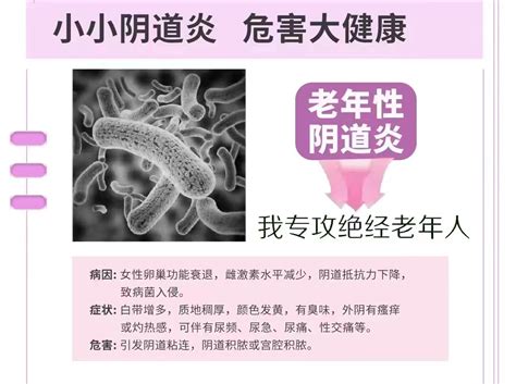 阴道炎：细菌、滴虫、霉菌，如何拯救你的痒？ 知乎