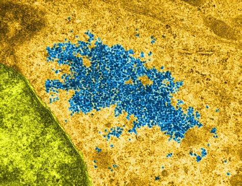 Glycogen TEM Stock Image C028 3589 Science Photo Library