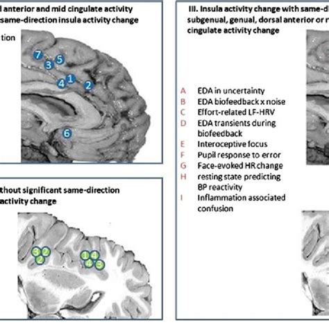 Subdivisions Of Cingulate Cortex According To The Four Subregion Model