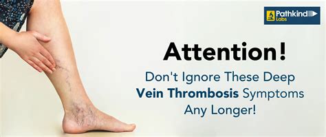 Deep Vein Thrombosis Symptoms Treatment Prevention And More