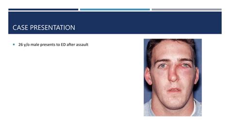 Nasal Bone Fractures Pptx
