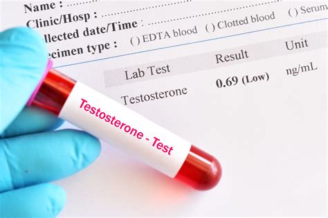 Signs Of Low Testosterone And Symptoms To Look Out For