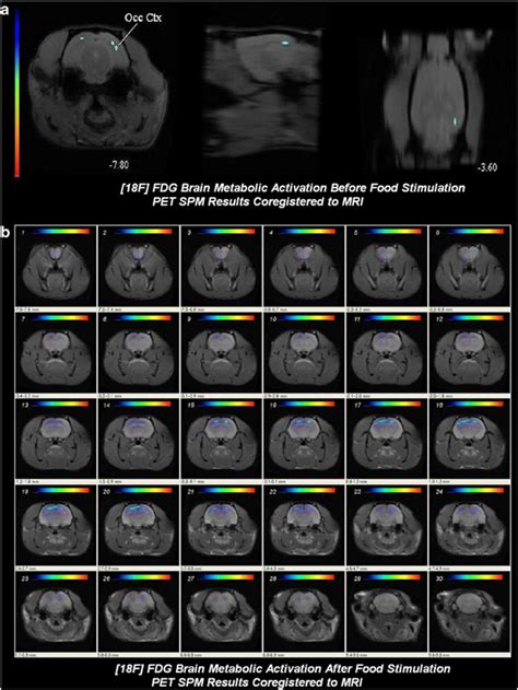 Representative Statistical Parametric Mapping Spm Images