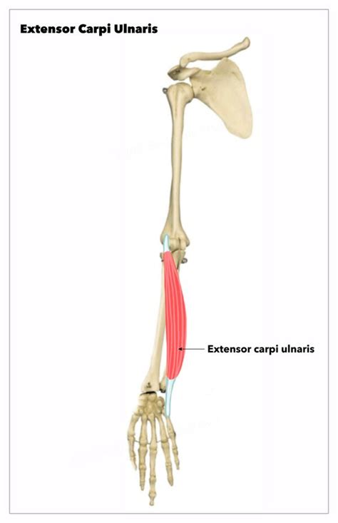 Extensor Carpi Ulnaris Ecu Subluxation Physiopedia