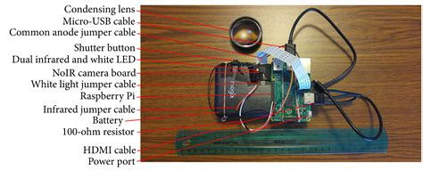 An Affordable Ocular Fundus Camera Raspberry Pi