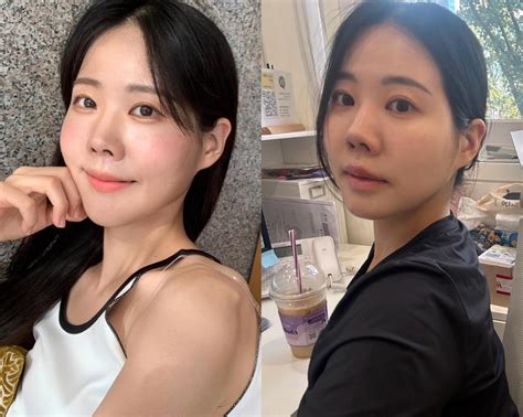 지난글에 이어 두번째 첫번째 유형에서 자기 얘기같았던 스친이 많지 자세한 해결법도 유형 정리후 차근차근 올릴예정이니 조금만 기다려줘 ♡ 2 골격형 잘못된 자세