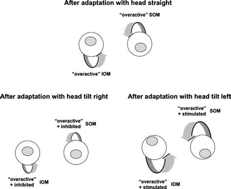 Vergence Adaptation Of Oblique Muscles As Hypothesized Explanation Of Download Scientific