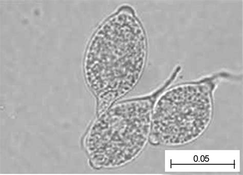 The Photomicrograph Showing The Spores Of The Phytophthora Palmivora Download Scientific