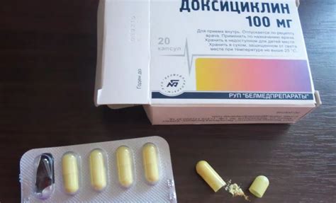 Доксициклин за деца: инструкции за употреба, дали е възможно да се даде ...