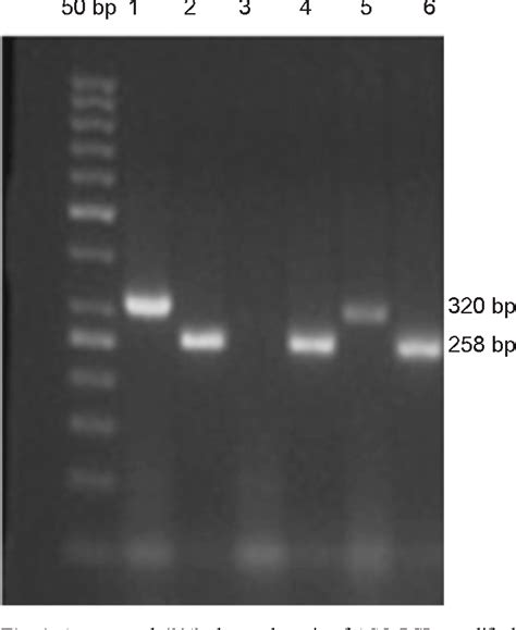 Figure 1 From Nucleophosmin Mutation Analysis In Acute Myeloid Leukaemia Immunohistochemistry
