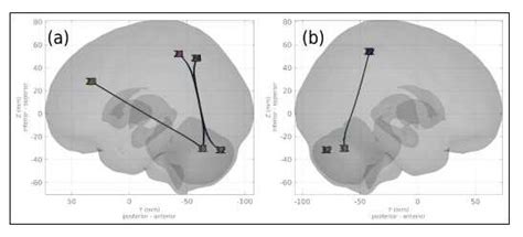 Brain Functional State Mapping In Resting State And Network Alteration
