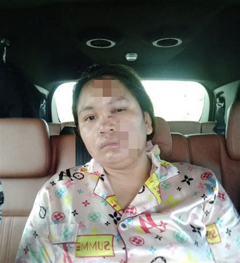 ជនជាតិចិនម្នាក់បើករថយន្តលឿនរេចង្កូតទៅកៀរស្ត្រីម្នាក់កំពុងបើកម៉ូតូបណ្ដាលឱ្យរងរបួសធ្ងន់