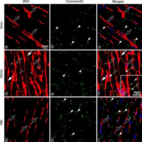 Confocal Laser Scanning Micrographs Of Double Immunofluorescence