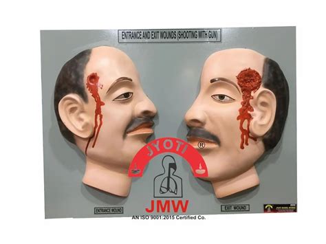 Fiber Entry Exit Wound At Piece In Ambala ID