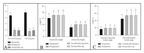 Application Of Stand Alone Oblique Lateral Interbody Fusion In L4 5 Lumbar Diseases Article Jove