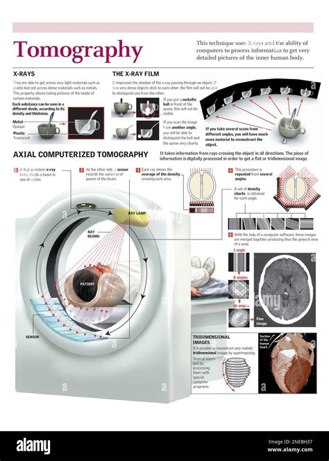 Infographics Of Imaging The Human Body Through Computerized Axial Tomography Adobe Illustrator