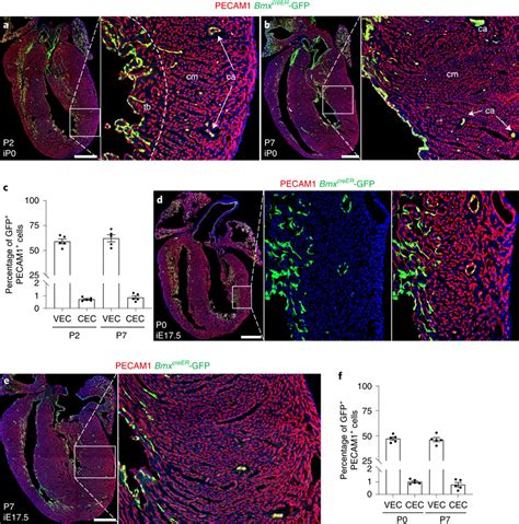 Perinatal Ventricular Endocardial Cells Labelled By Bmxcreer Do Not