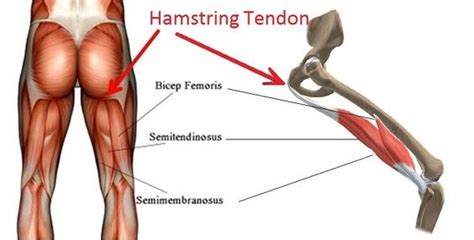 Proximal Hamstring Tendon