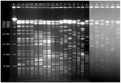 Pfge Patterns Of 35 Cns E Cloacae Isolates Pfge Fingerprinting Was