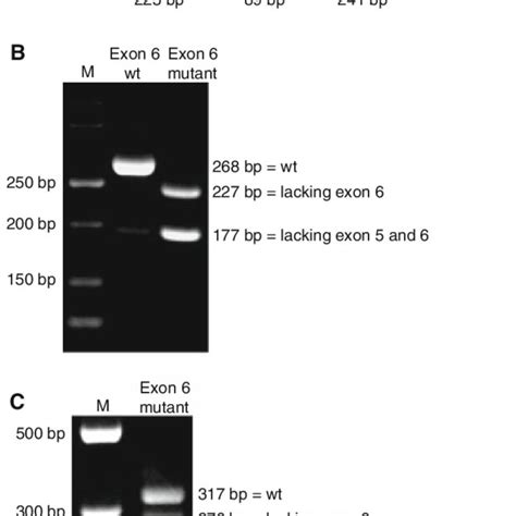 Exon Trapping And Rt Pcr Analysis A Structure Of The Exon Trapping