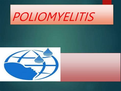 Poliomyelitispptx Free Download