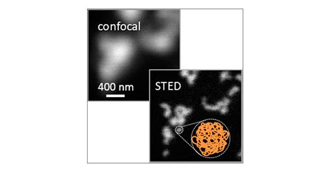 Bringing Far Field Subdiffraction Optical Imaging To Electronically