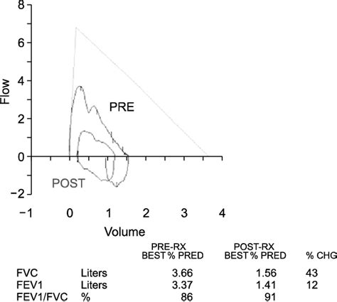 Pulmonary Function Test Revealed Moderate To Severe Restriction Fvc Download Scientific