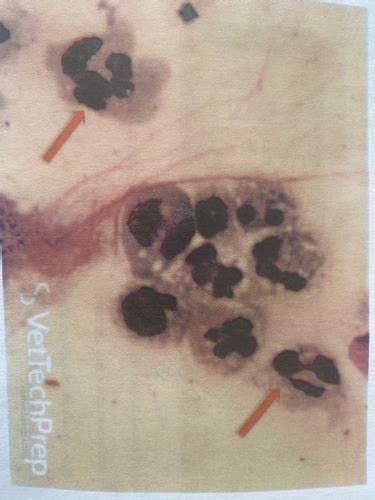 Clin Path Cytology Photos Flashcards Quizlet