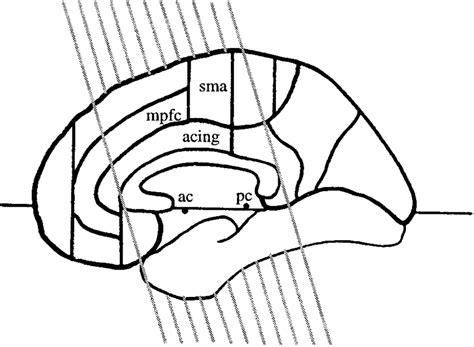 Midline Volumes Of Interest And Slice Placement Gray Lines Represent Download Scientific