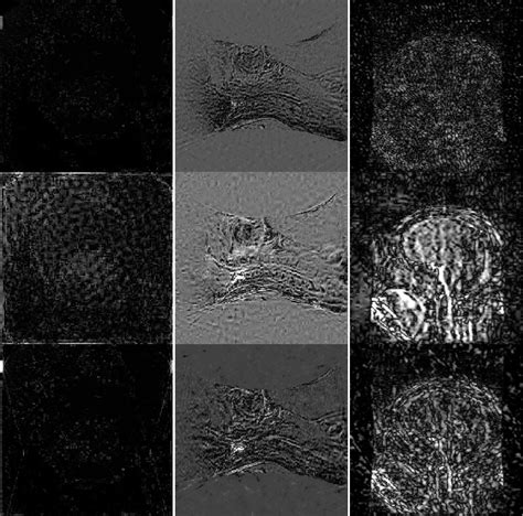Figure 1 From Real Time Dynamic Mri Reconstruction Using Stacked
