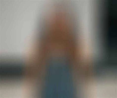 Understanding Toxic Conjunctivitis Causes Symptoms And Care