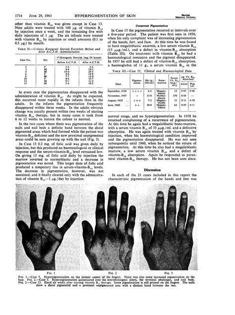 Hyperpigmentation Of Skin PMC