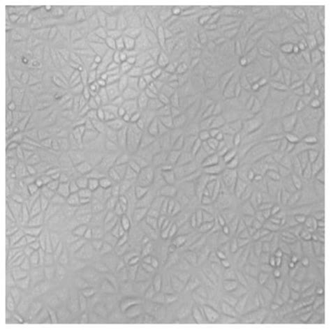 Method For Inactivating Vesicular Stomatitis Viruses Eureka Patsnap