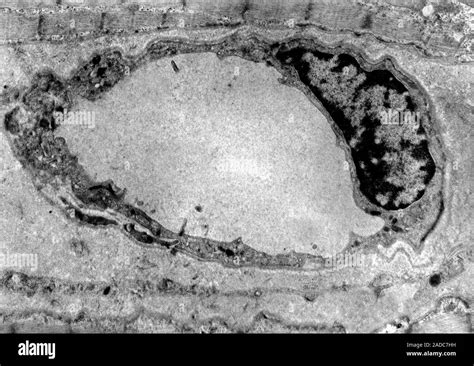 Transmission Electron Micrograph Tem Showing A Capillary Of The Myocardium The Endothelial