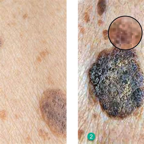 An Example Of Performing General Histogram Enhancement Of The Skin