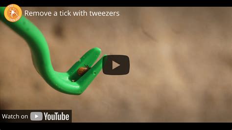 How To Remove A Tick The Tick App