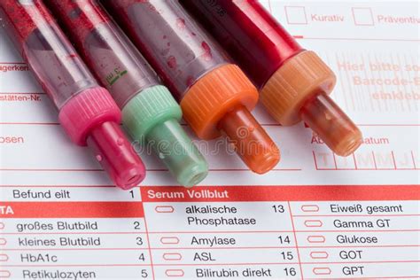 Blood Test Blood Samples On A Laboratory Form Stock Photo Image Of