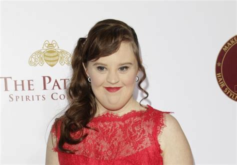 How To Become An Actor With Down Syndrome Backstage