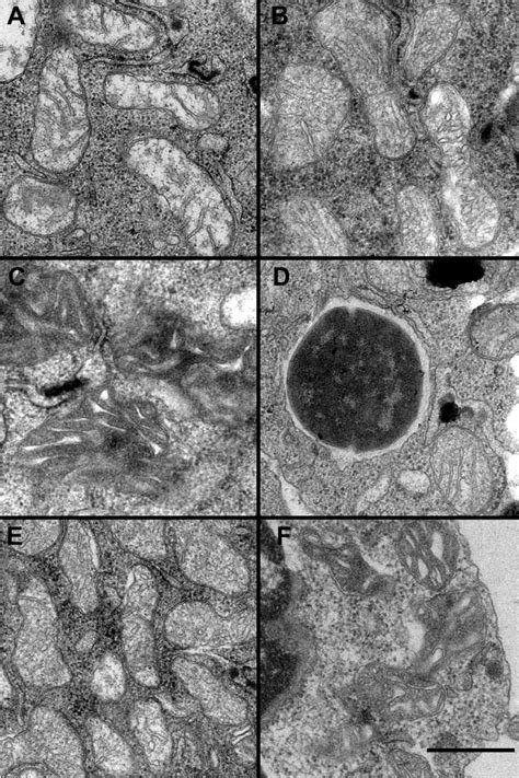 Electron Microscopy Reveals Cristae Remodeling Within Mitochondria Of