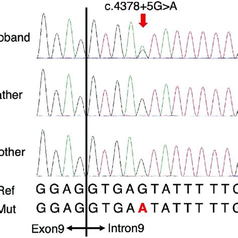 Molecular Findings Sanger Sequencing Electropherogram Showing The De Download Scientific